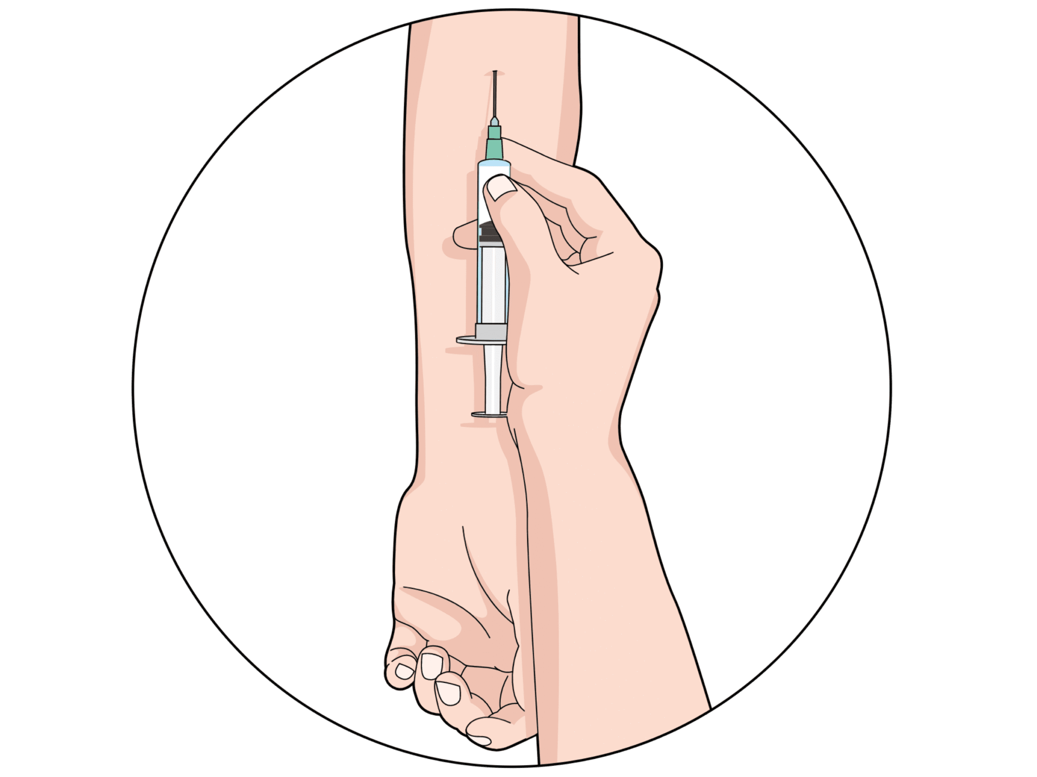 Routes of Drug Administration | Pharmacology Mentor
