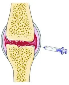 Routes of Drug Administration | Pharmacology Mentor