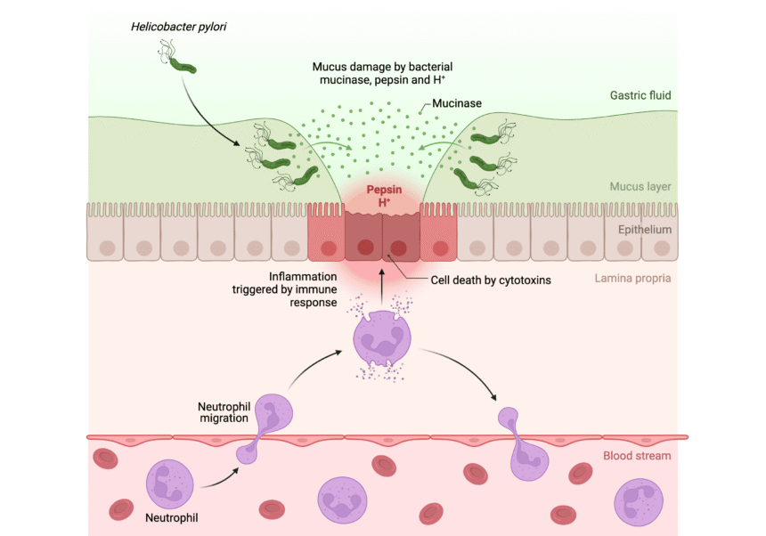 Helicobacter pylori Infection | Pharmacology Mentor